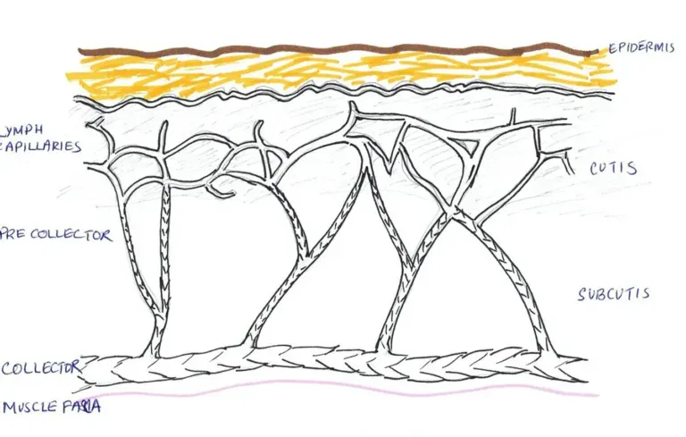 Manual Lymphatic Drainage Perth | Lymphoedema Treatment & Pain Relief